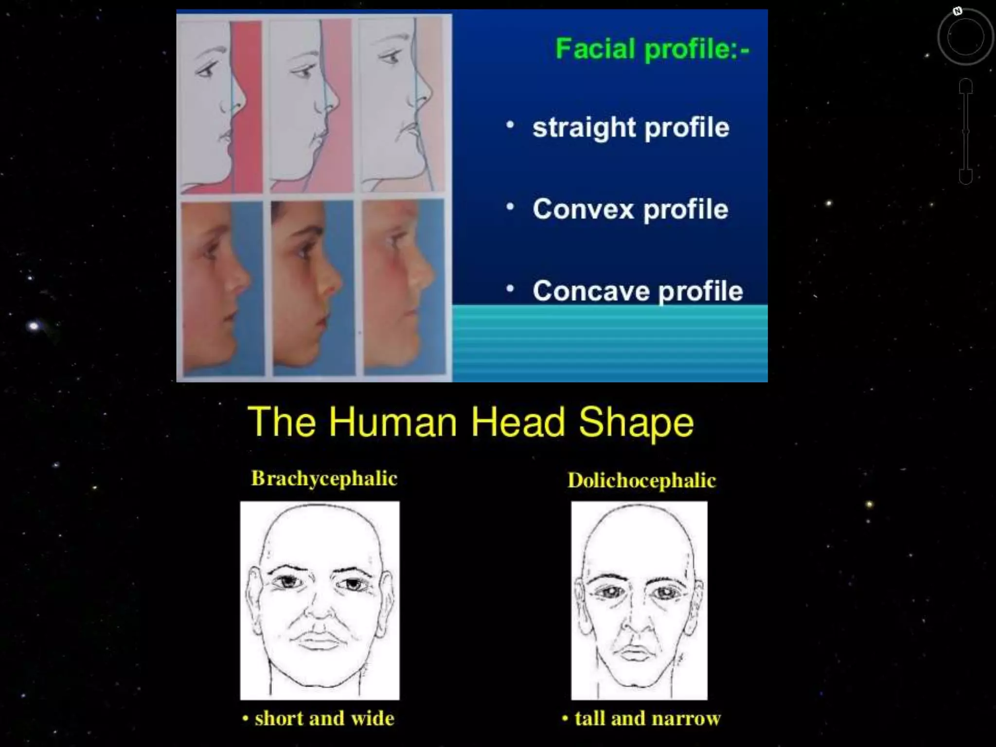 Class ii div 2 malocclusion | PPTX