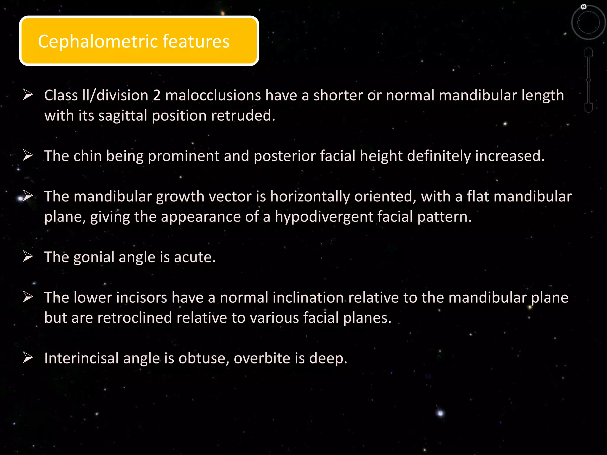 Class ii div 2 malocclusion | PPTX