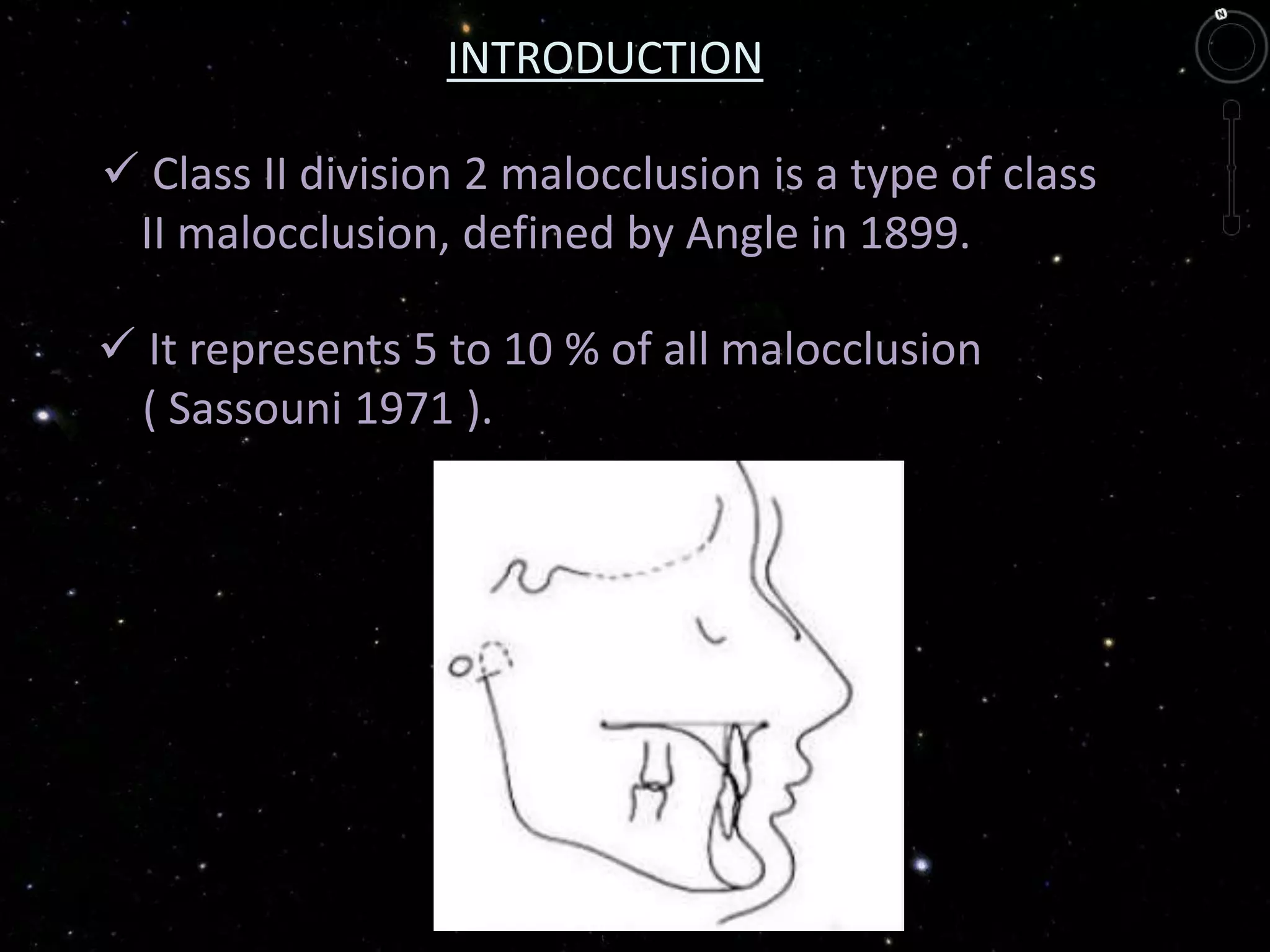 Class ii div 2 malocclusion | PPTX