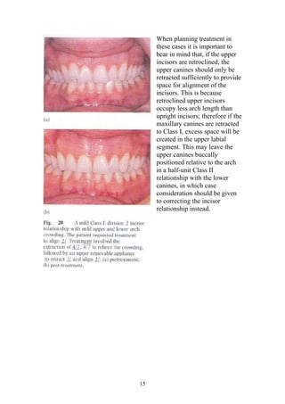 Class ii division 2 | DOC