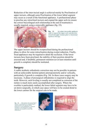 Class ii division 2 | DOC