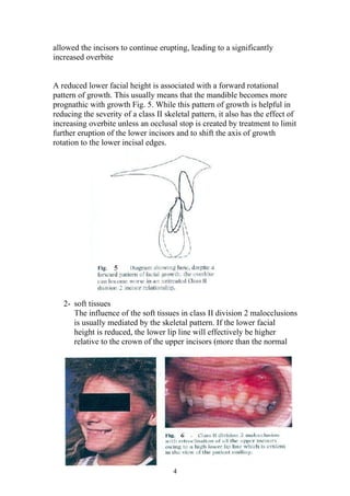 Class ii division 2 | DOC