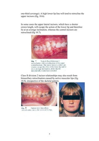 Class ii division 2 | DOC