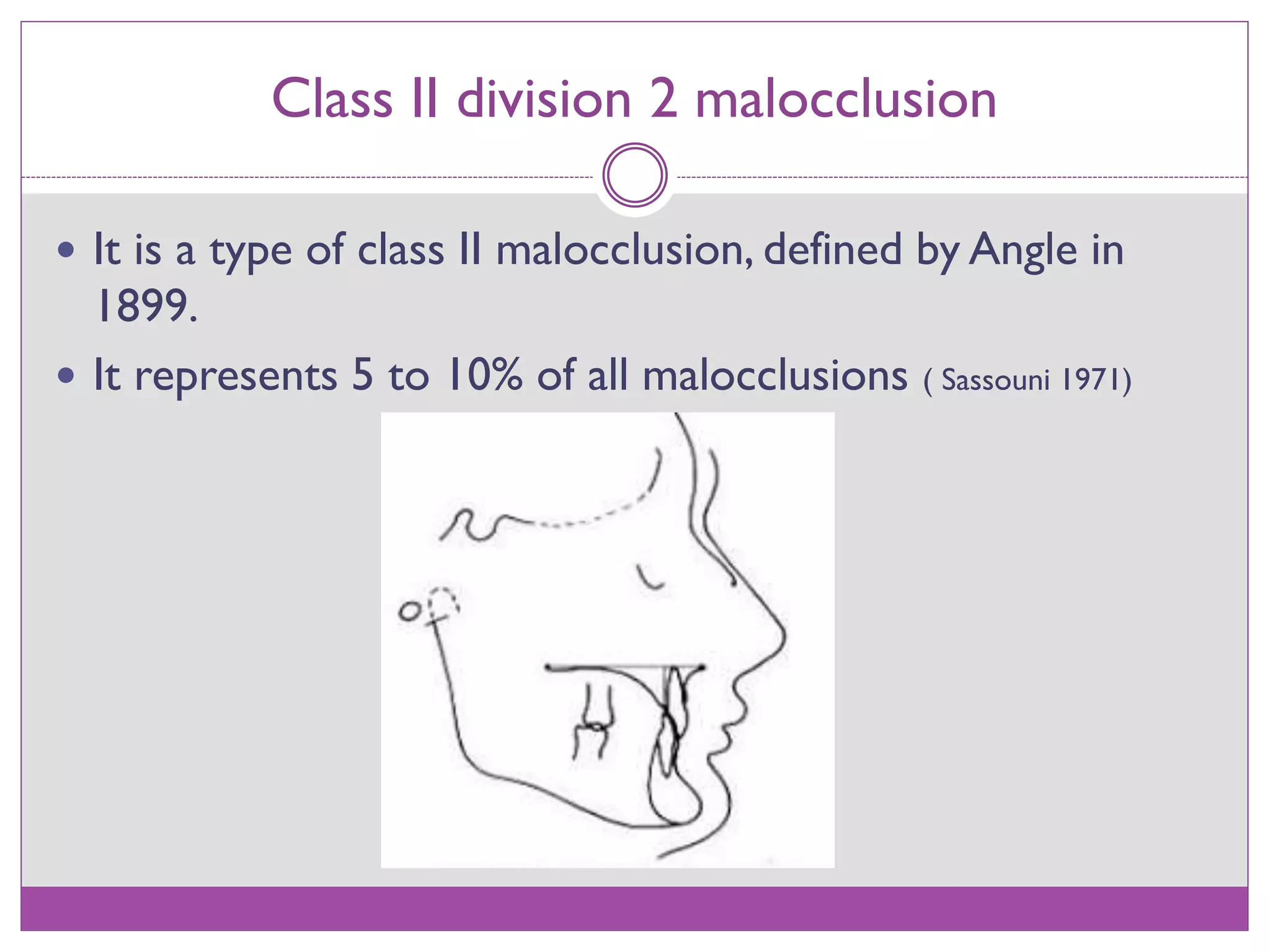 Class II division 2 malocclusion | PPTX