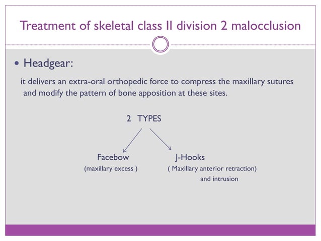 Class II division 2 malocclusion | PPTX