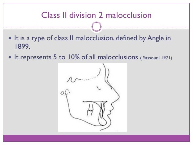 Class II division 2 malocclusion