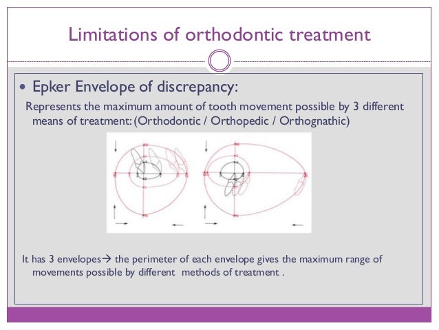 Class II division 2 malocclusion