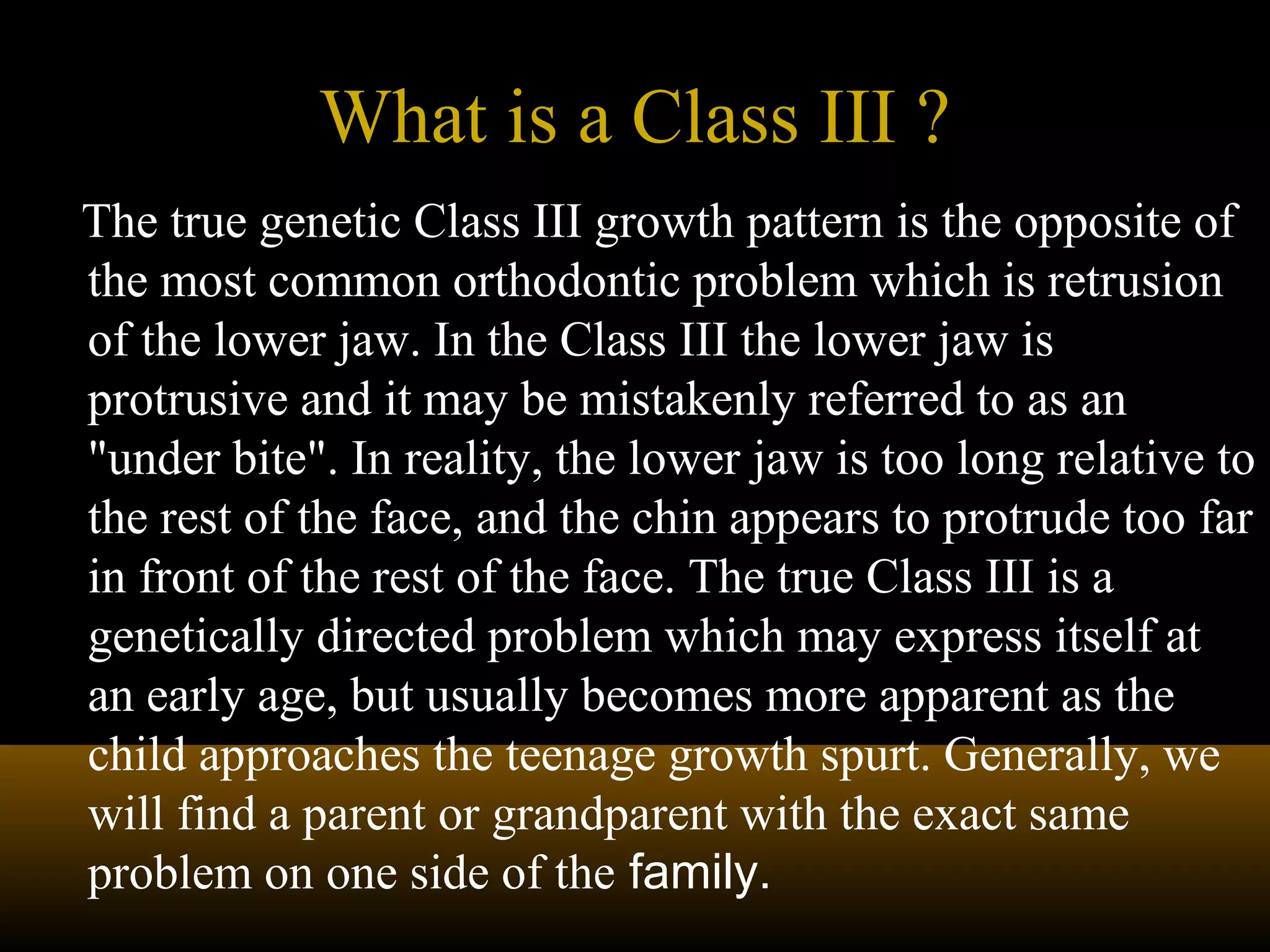 Non surgical management of skeletal Class 3 malocclusion | PPT