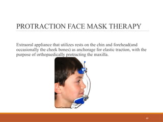 CLASS III.pptx malocclusion, diagnosis,GTRV, TREATMENT | PPTX