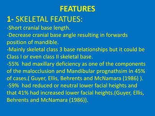 Class 3 malocclusion | PPTX