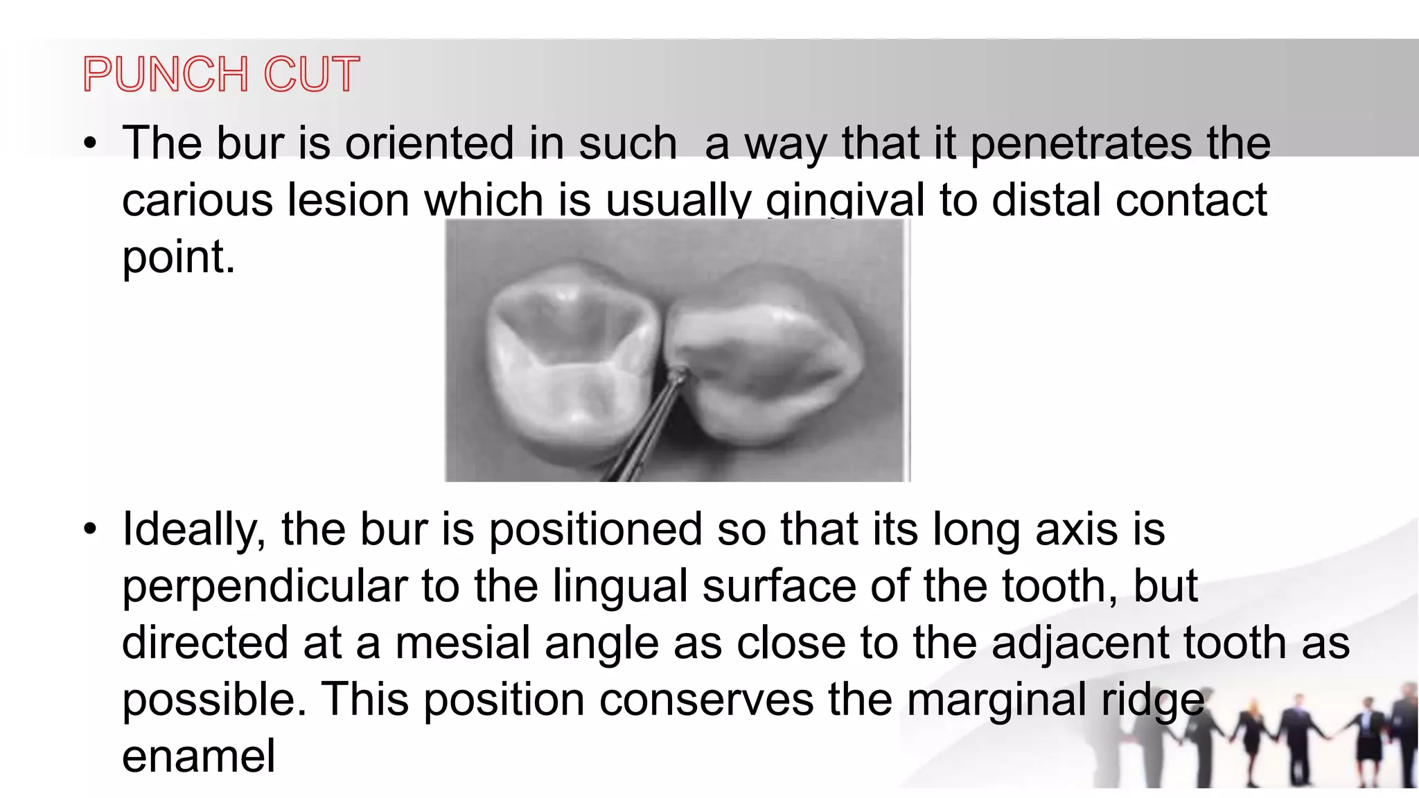 Class iii cavity preparation | PPTX