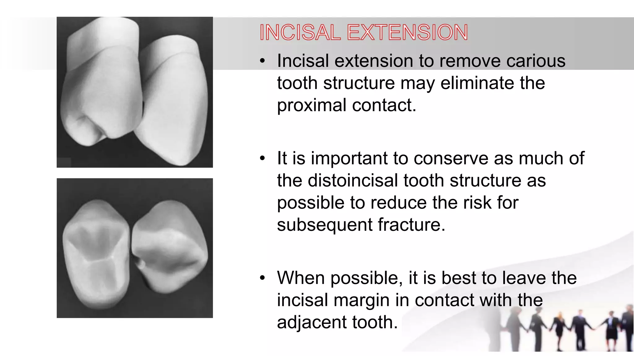 Class iii cavity preparation | PPTX