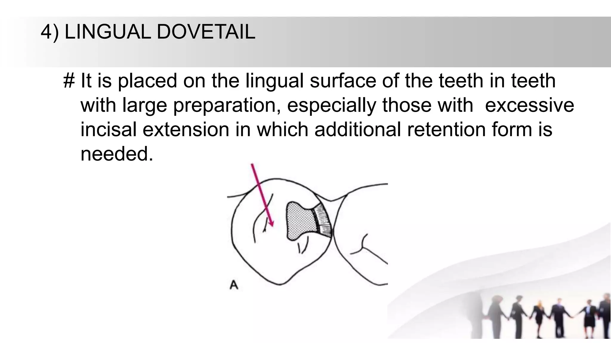 Class iii cavity preparation | PPTX