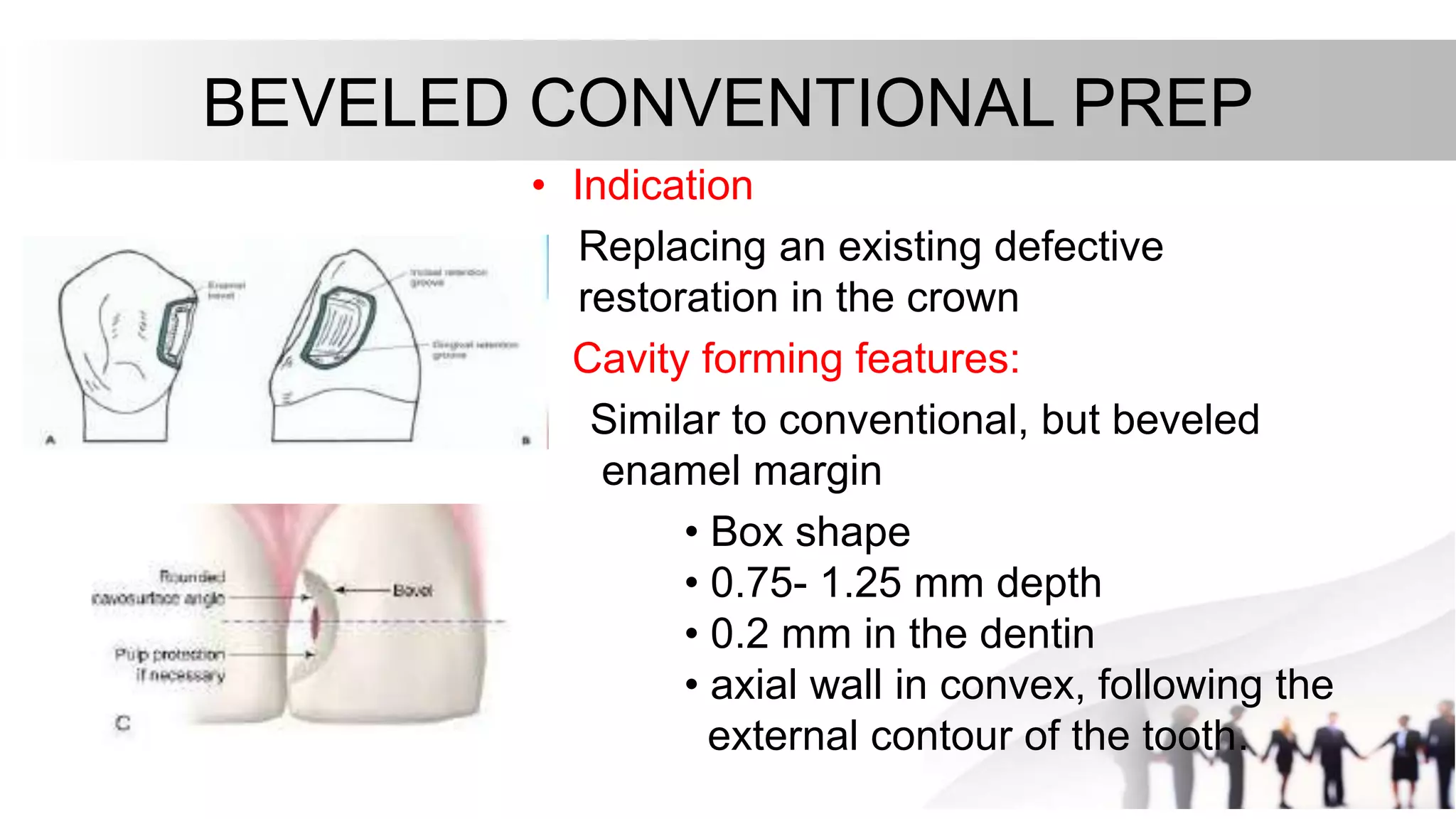 Class iii cavity preparation | PPTX | Dental Health | Diseases and ...