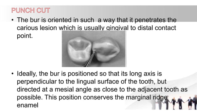 Class iii cavity preparation | PPTX | Dental Health | Diseases and ...