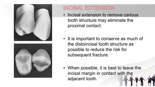 Class iii cavity preparation | PPTX | Dental Health | Diseases and ...
