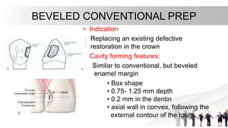 Class iii cavity preparation | PPT