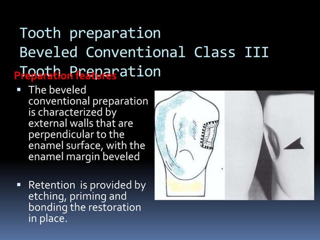 class 1 and iirgbhnvcdxzxvjhvjhcgvxzzdgcghvjhjkjhvjh | PPT