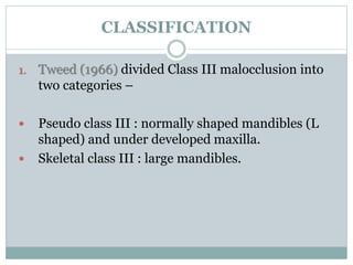 Class iii m.o | PPTX