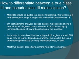 Class iii malocclusion | PPTX