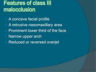 Class iii malocclusion | PPTX
