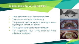 Class III malocclusion | PPTX