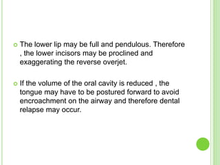 Class III Malocclusion | PPTX | Dental Health | Diseases and Conditions