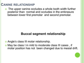 Class III Malocclusion | PPTX | Dental Health | Diseases and Conditions