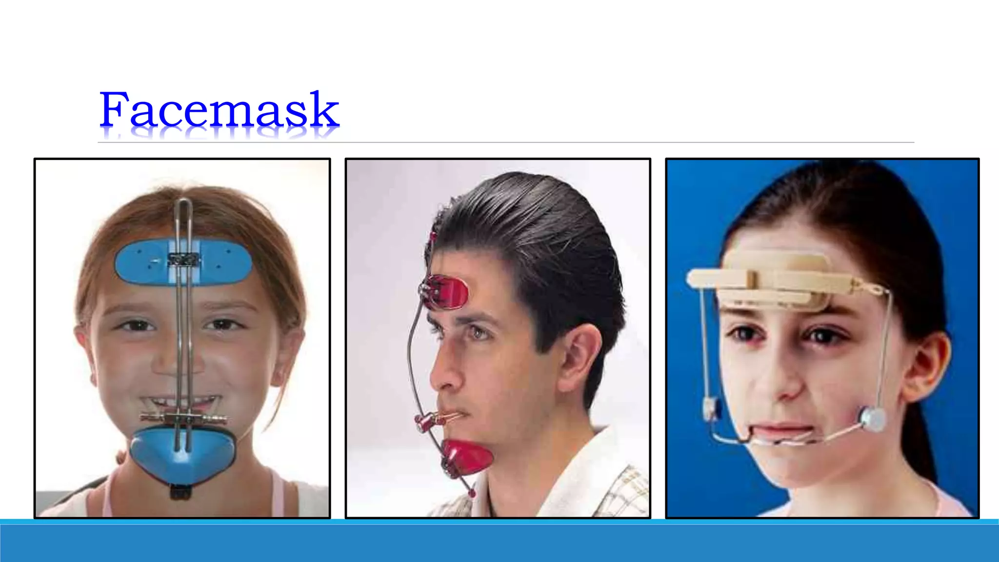 Class iii malocclusion | PPTX