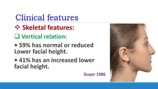 Class iii malocclusion | PPTX