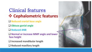 Class iii malocclusion | PPTX