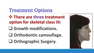 Class iii malocclusion | PPTX