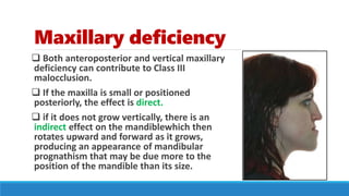 Class iii malocclusion | PPTX