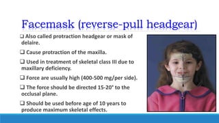 Class iii malocclusion | PPTX