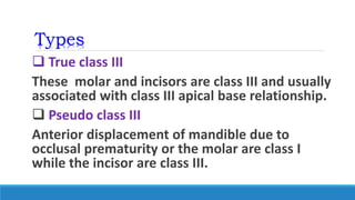 Class iii malocclusion | PPTX