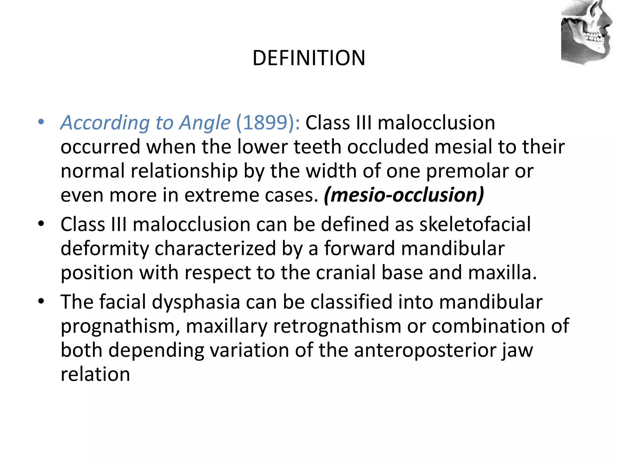 Class iii malocclusion | PPT