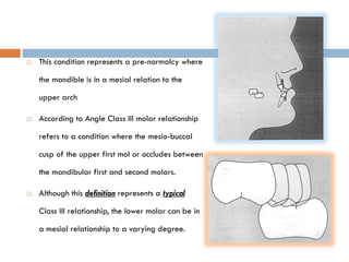 Class III Malocclusion - Dr. Nabil Al-Zubair | PDF