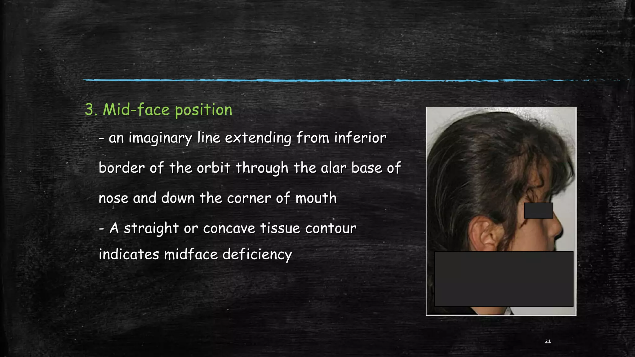 Class III malocclusion seminar | PPTX