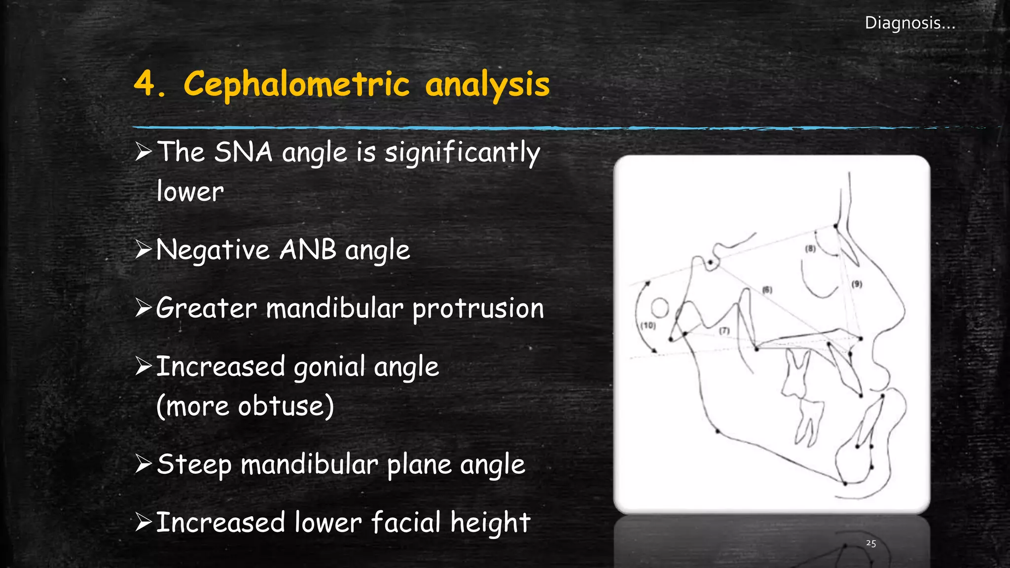 Class III malocclusion seminar | PPTX