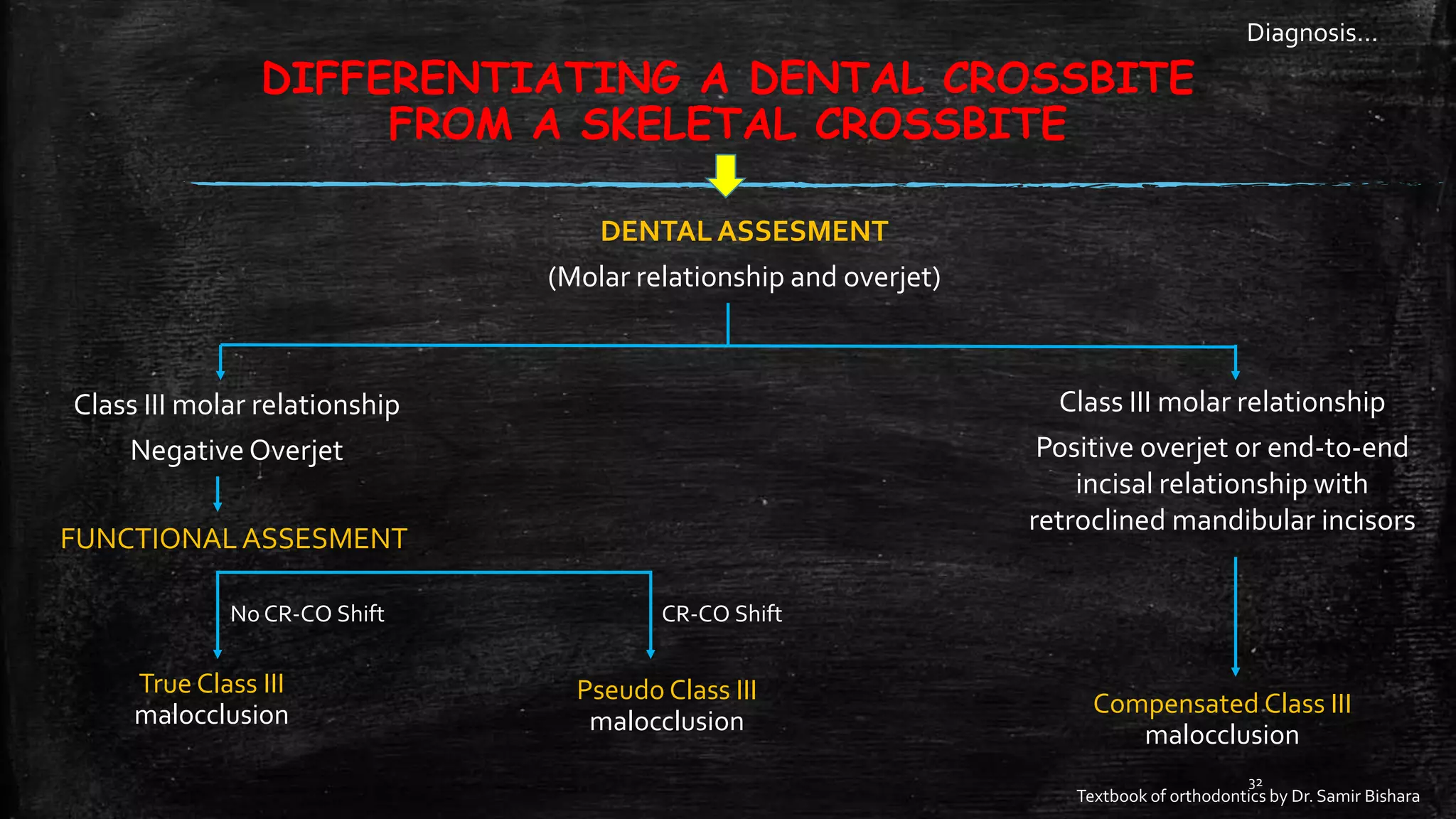 Class III malocclusion seminar | PPTX