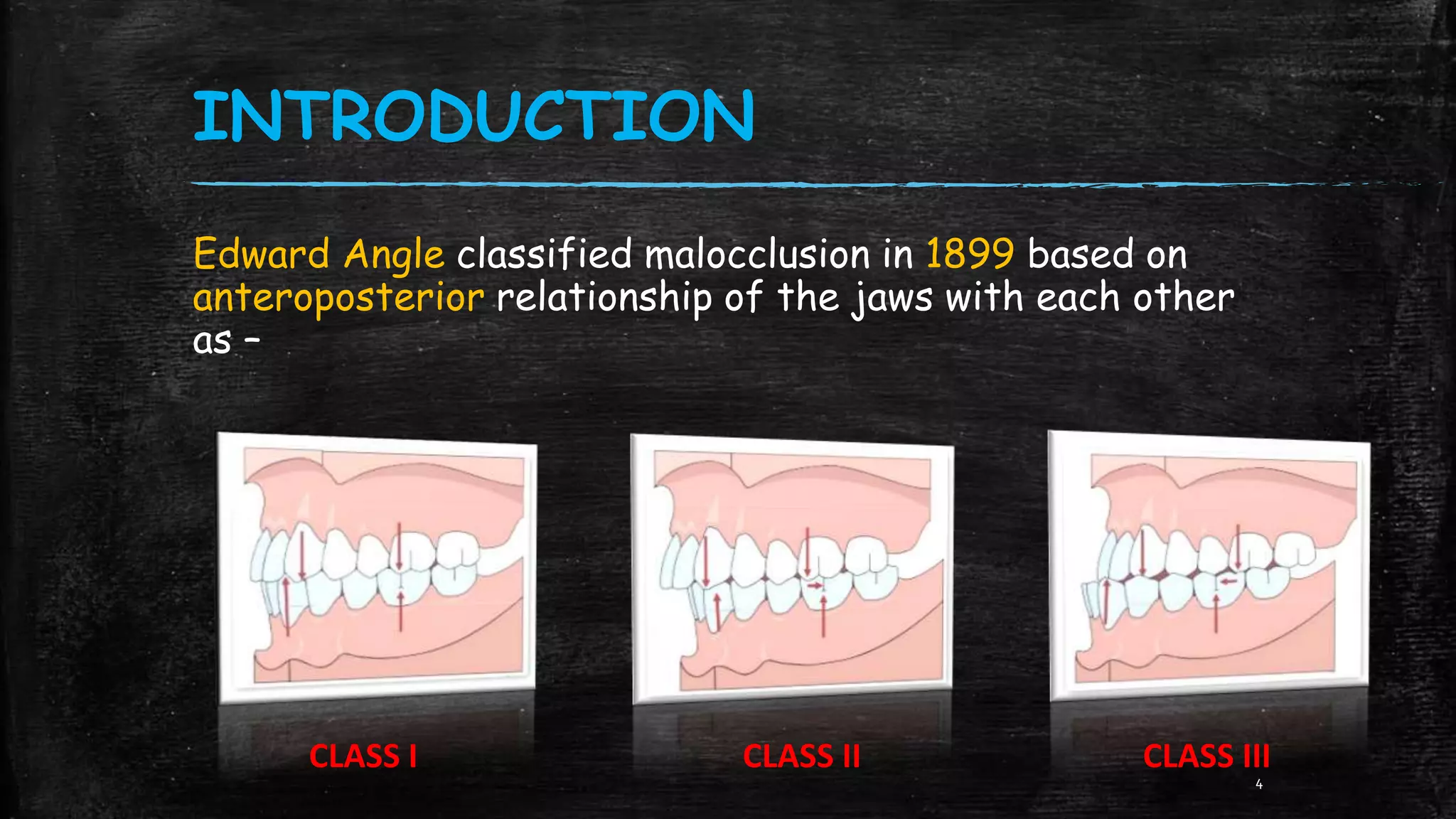Class III malocclusion seminar | PPTX