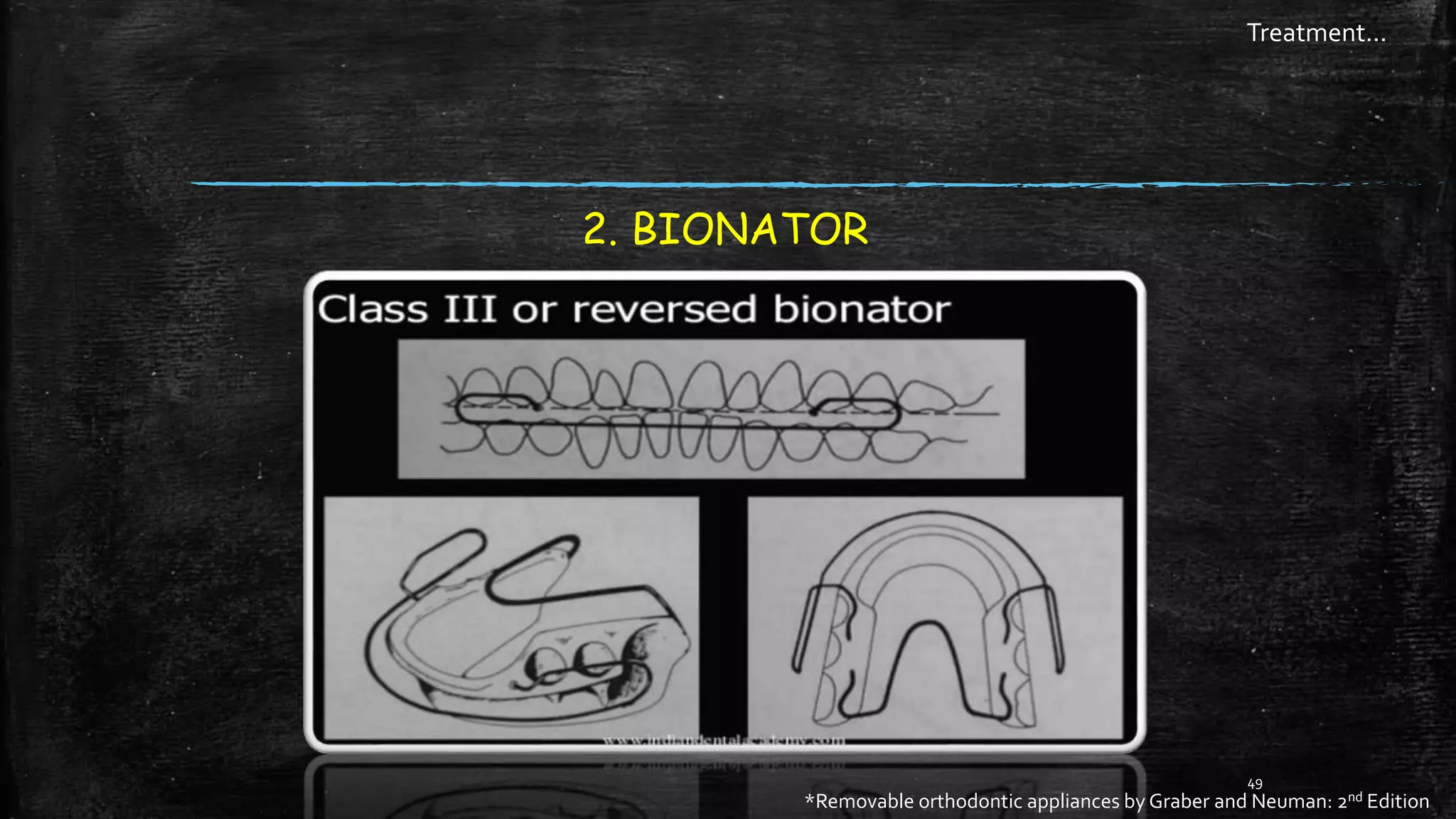 Class III malocclusion seminar | PPTX