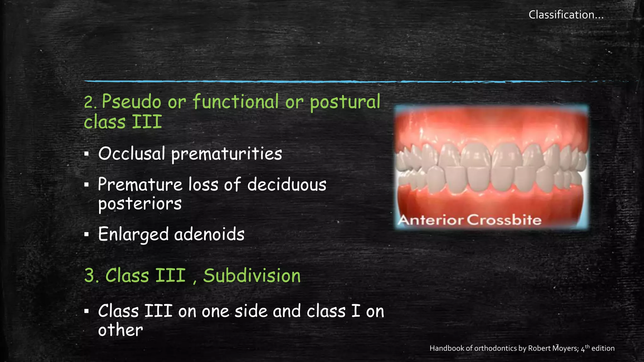 Class III malocclusion seminar | PPTX