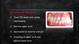 Class III malocclusion seminar | PPTX