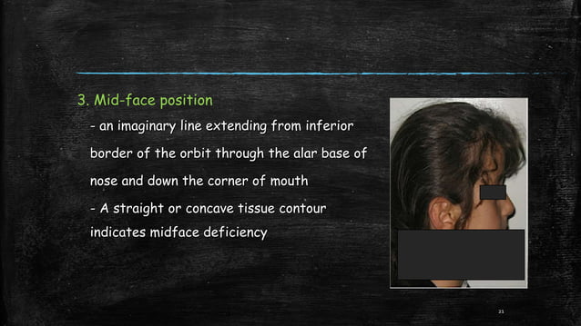 Class III malocclusion seminar | PPTX | Dental Health | Diseases and ...