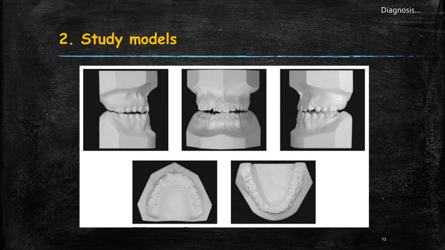 Class III malocclusion seminar | PPTX | Dental Health | Diseases and ...