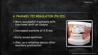 Class III malocclusion seminar | PPTX