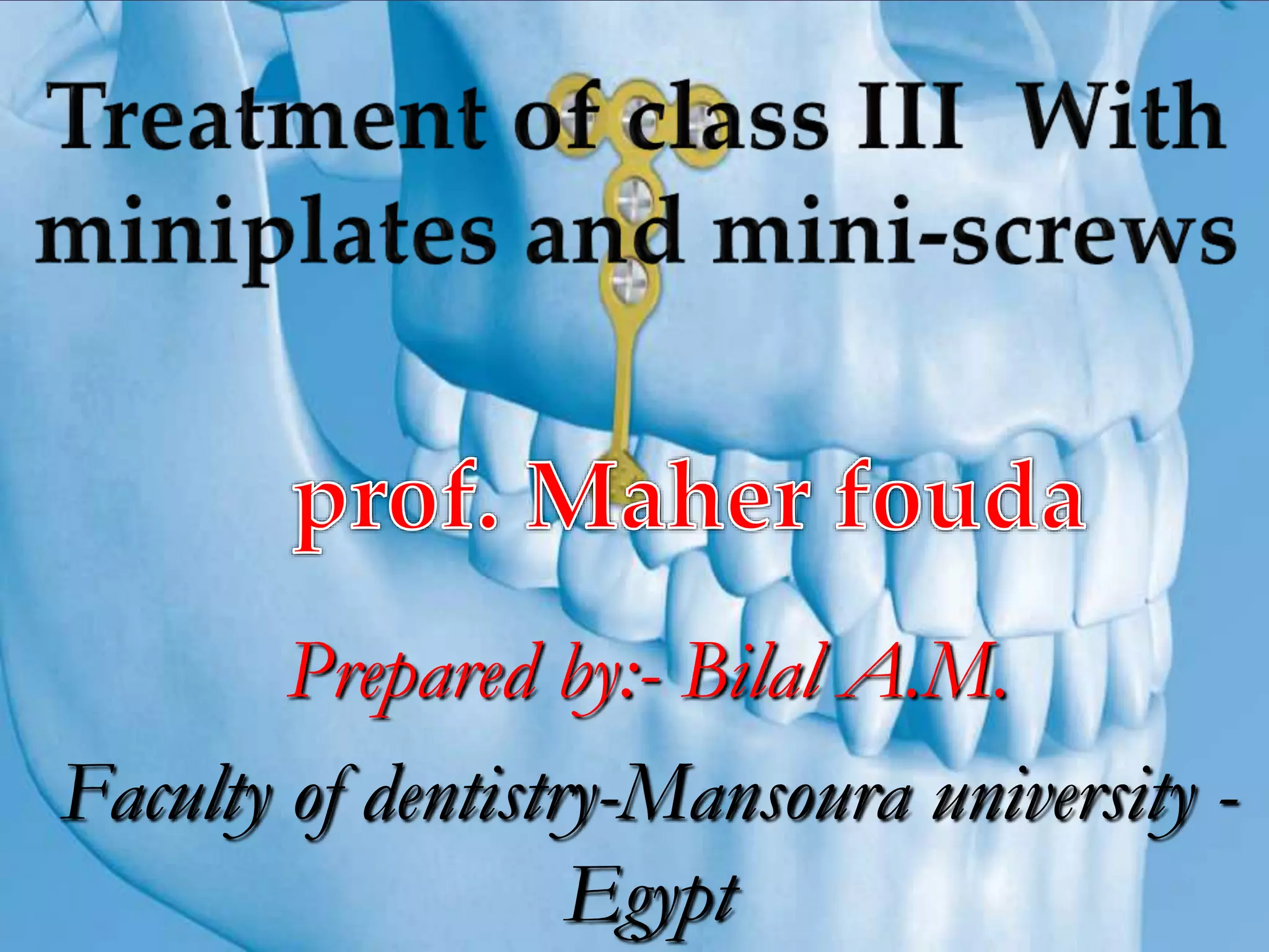 treatment of Class III with skeletal anchorage by miniplates | PPTX