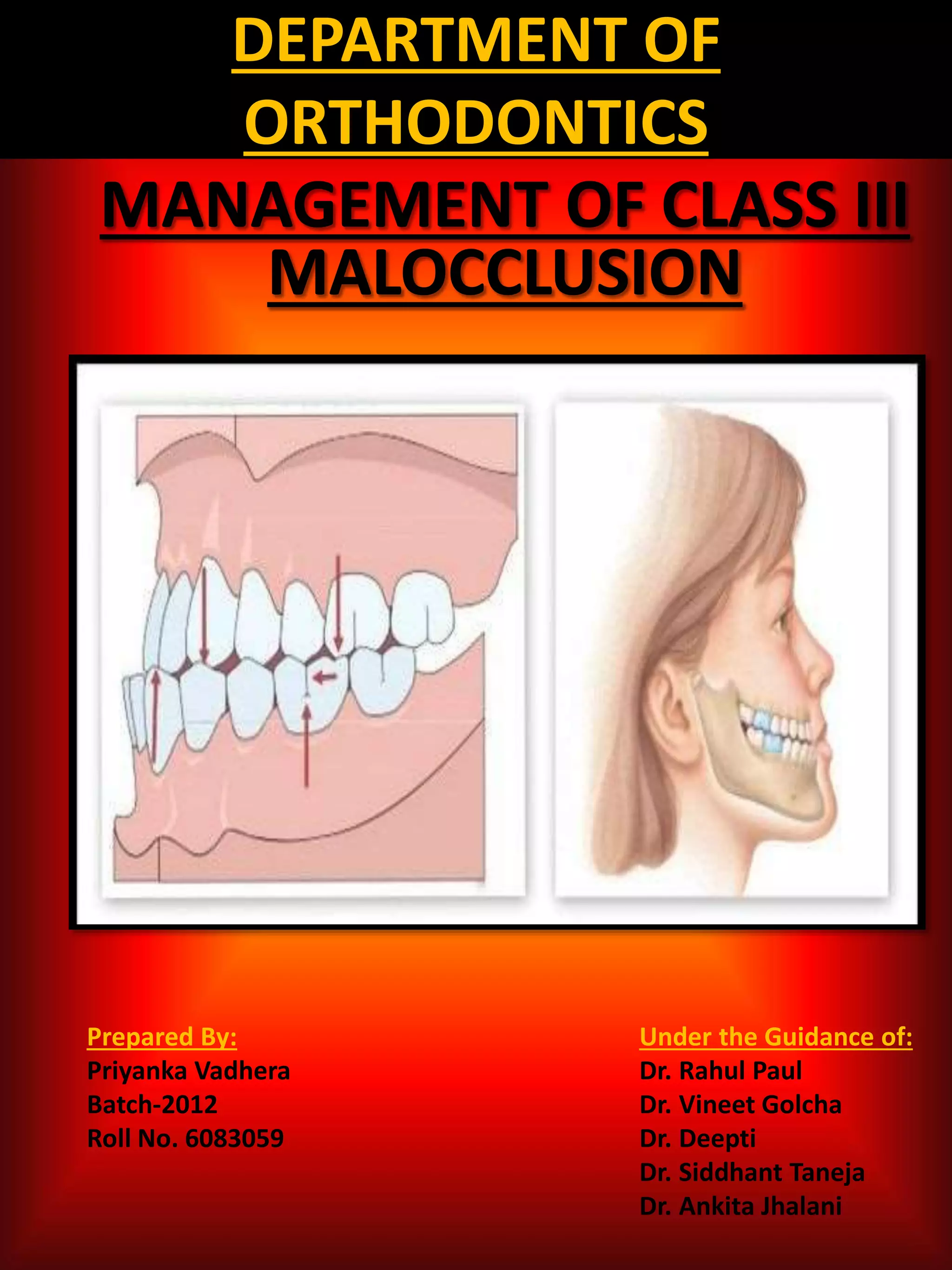 Class III Malocclusion | PPTX