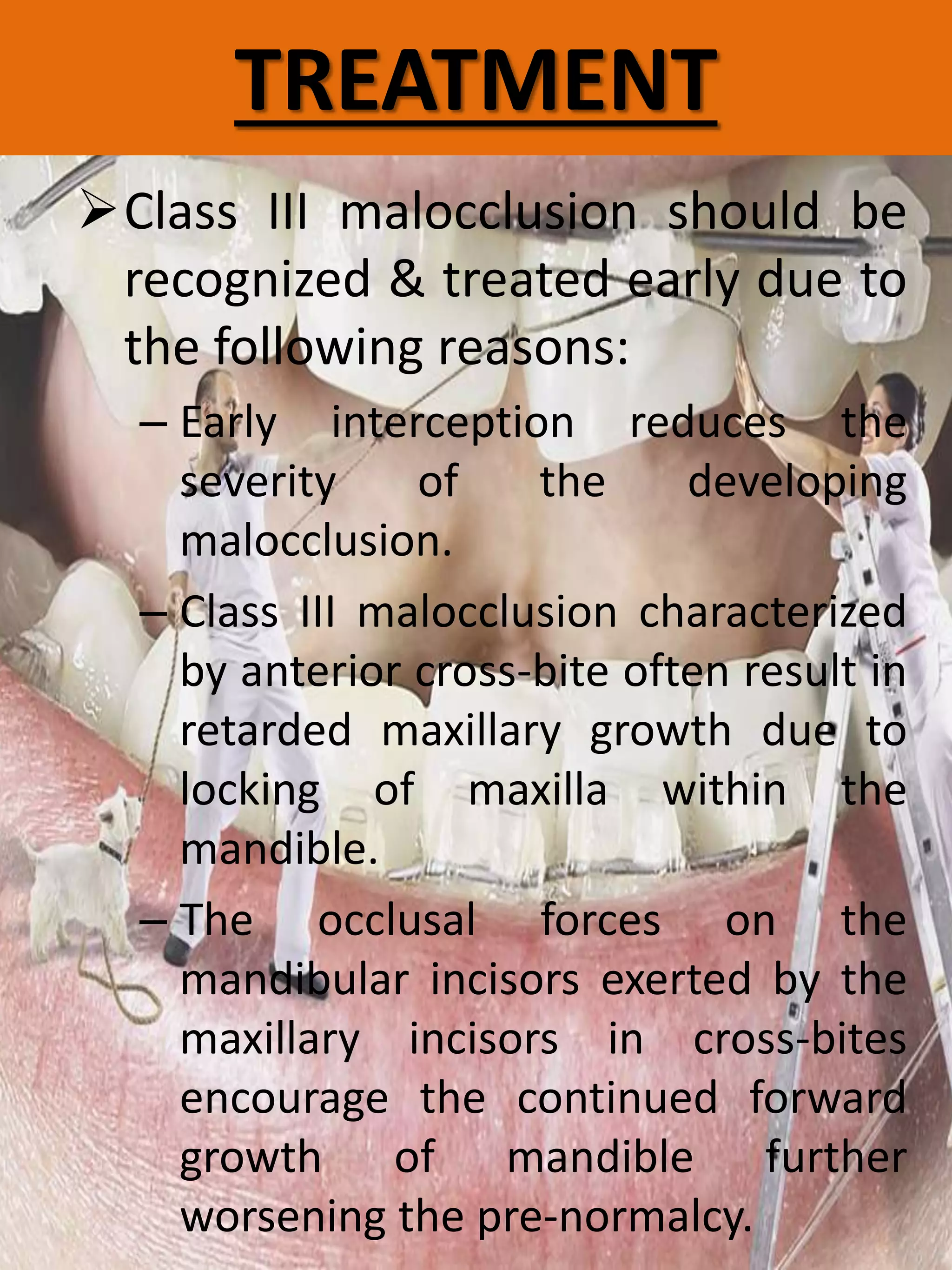 Class III Malocclusion | PPTX